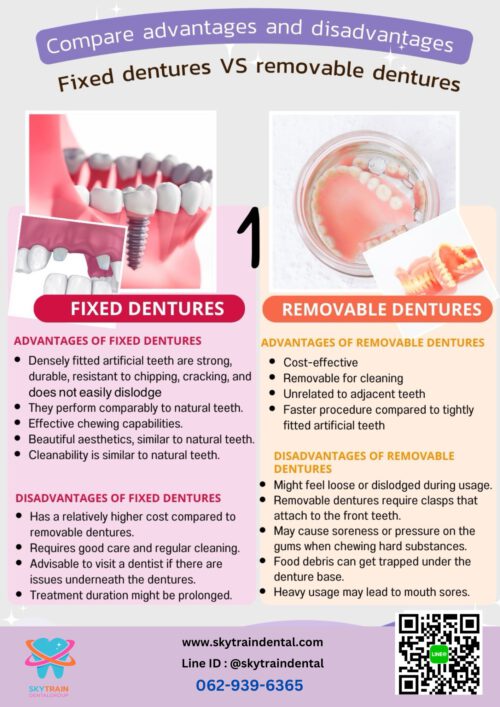 The difference between removable dentures and fixed dentures - Skytrain ...