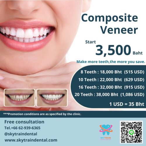How Much Does It Cost to Get Veneers in Bangkok, Thailand? | Dental ...